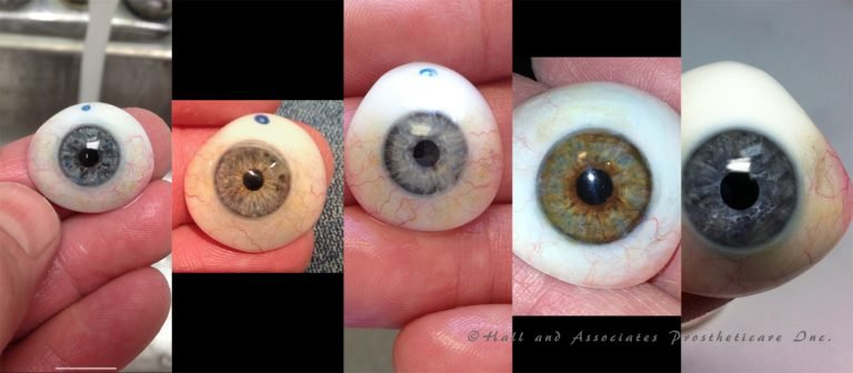 Prosthetic Eyes and Scleral Lenses - Hall & Associates Prostheticare Inc.